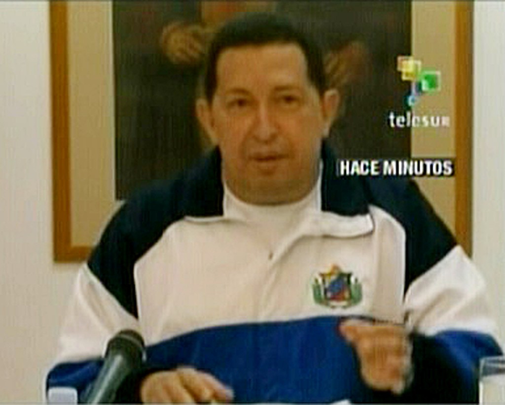 Univisión asegura que a Chávez le extrajeron parte del intestino y próstata