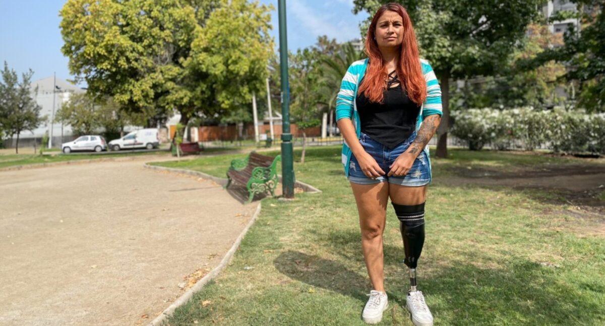 Mujer que se operó con implantes mamarios y terminó con una pierna ...