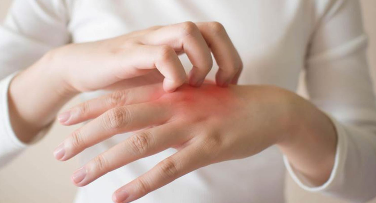 Esto es lo que le pasa a tu cuerpo al rascarte una comezón: tiene ...